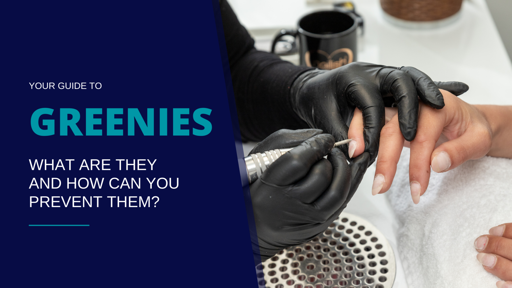 Greenies: What They Are And How To Prevent Them | Nail Care